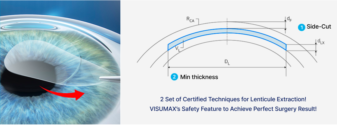 BGSS EYE CLINIC-밝은세상안과 서울l부산